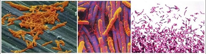 C. difficile and Probiotics | Professionals